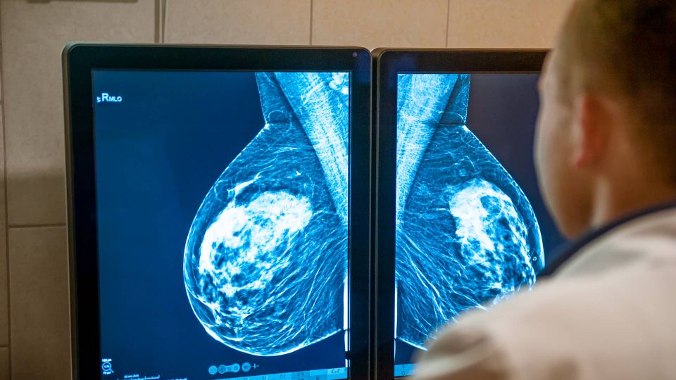 WHO venter 77 prosent flere krefttilfeller i 2050